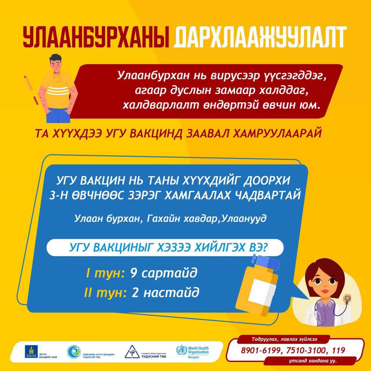 Улаанбурхан өвчин нь халдварлалт өндөртэй ч вакцинаар сэргийлэгдэх боломжтой халдварт өвчин юм